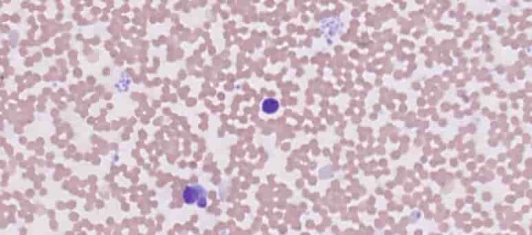 May Grünwald Giemsa Stain Kit - iqmstore